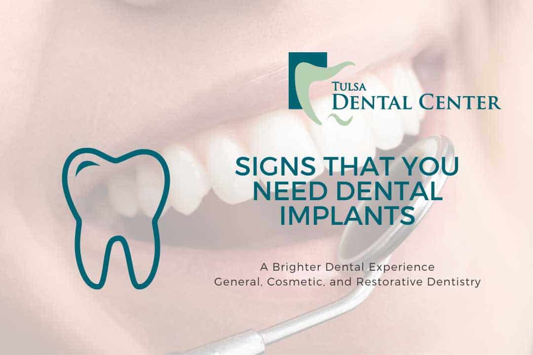 Signs That You Need Dental Implants
